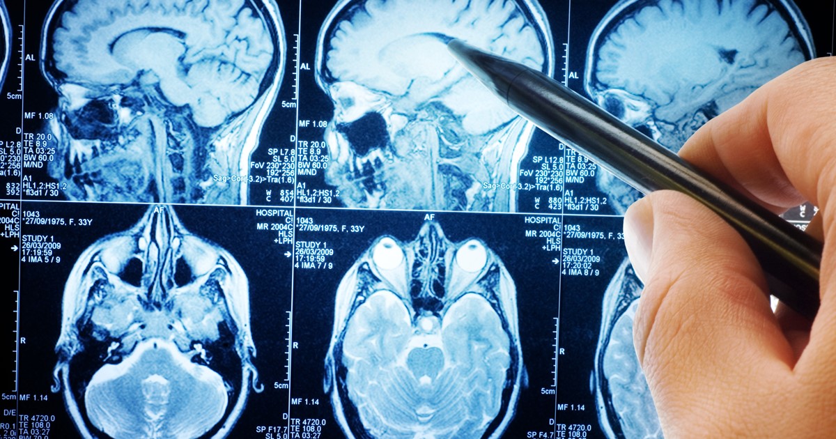 Neurology Forensic Services | Forensic Access
